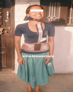 ORTHOTICS PROSTHETICS RESEARCH